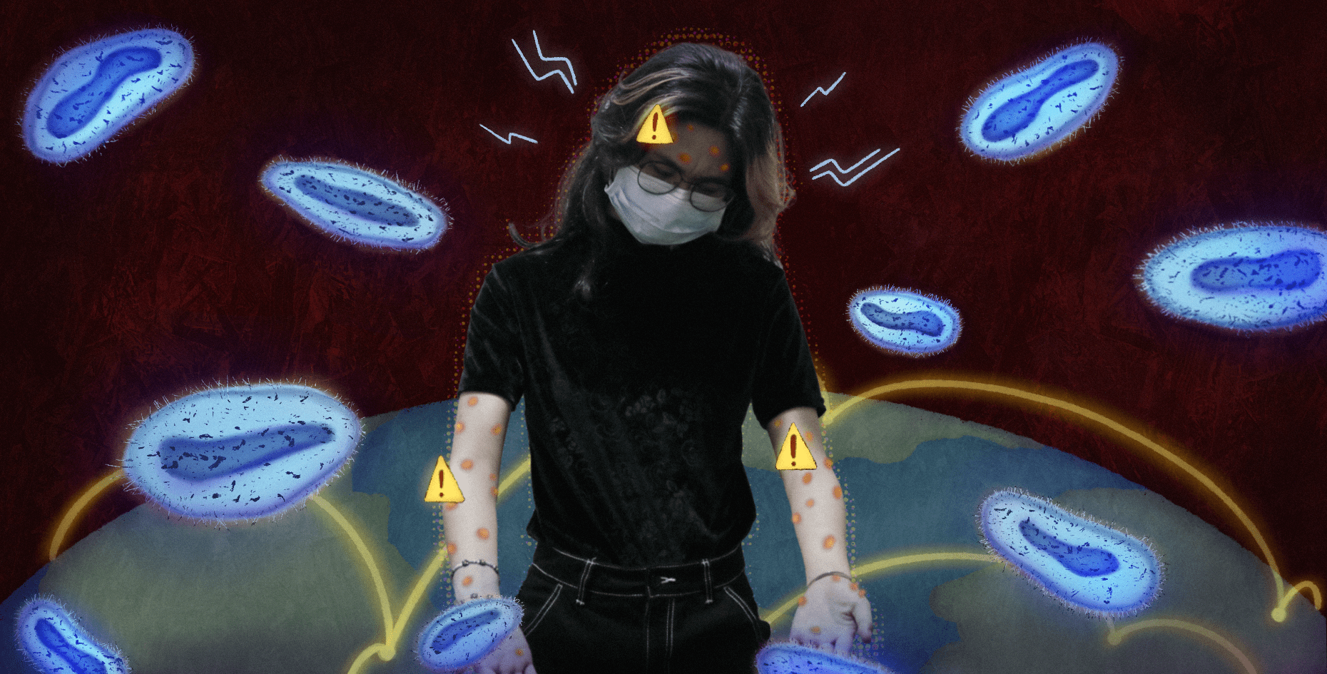 Addressing questions, concerns, and misinformation about monkeypox ...